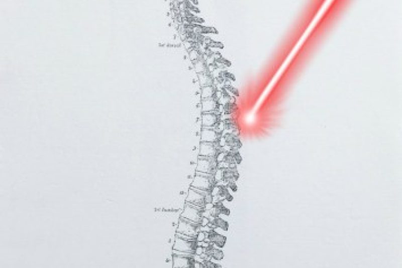 Blog | Precision Spine & Orthopedics Inc
